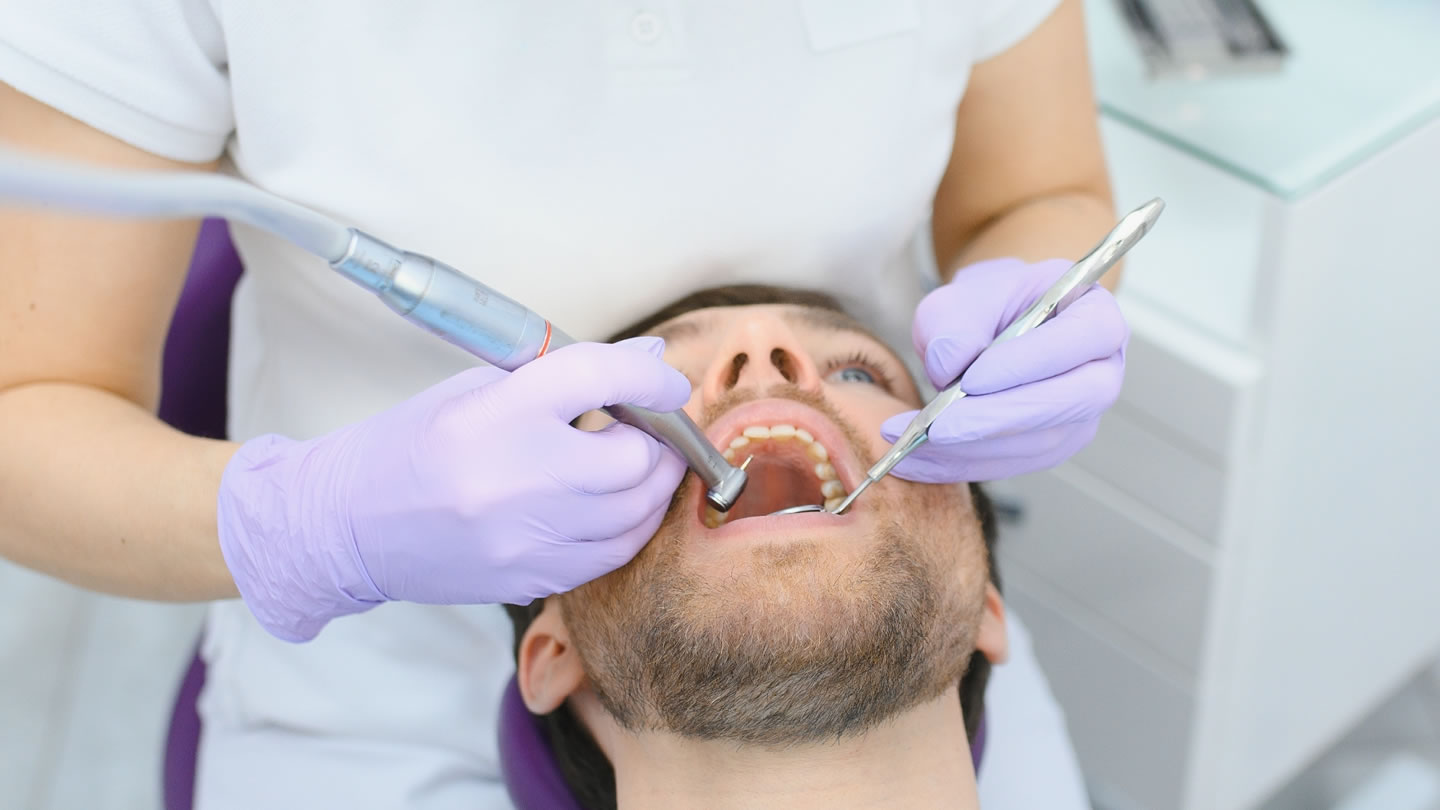 Fissure Sealants | Jacaranda dental
